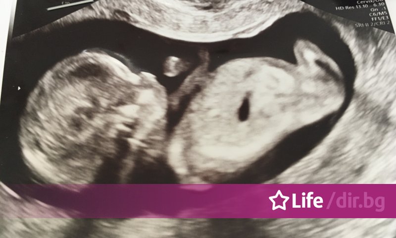 Лео за първи път пред очите на мама в третия месец от бременността Лайф Dir Bg